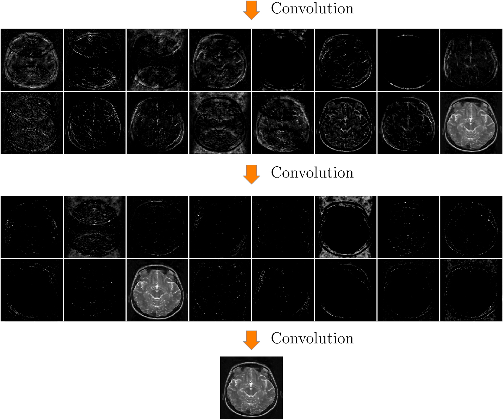 Deep learning for undersampled MRI reconstruction - IOPscience
