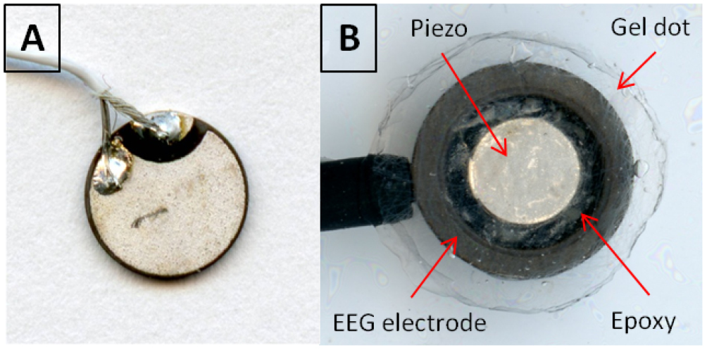 Scalp sensor for simultaneous acoustic emission detection and ...