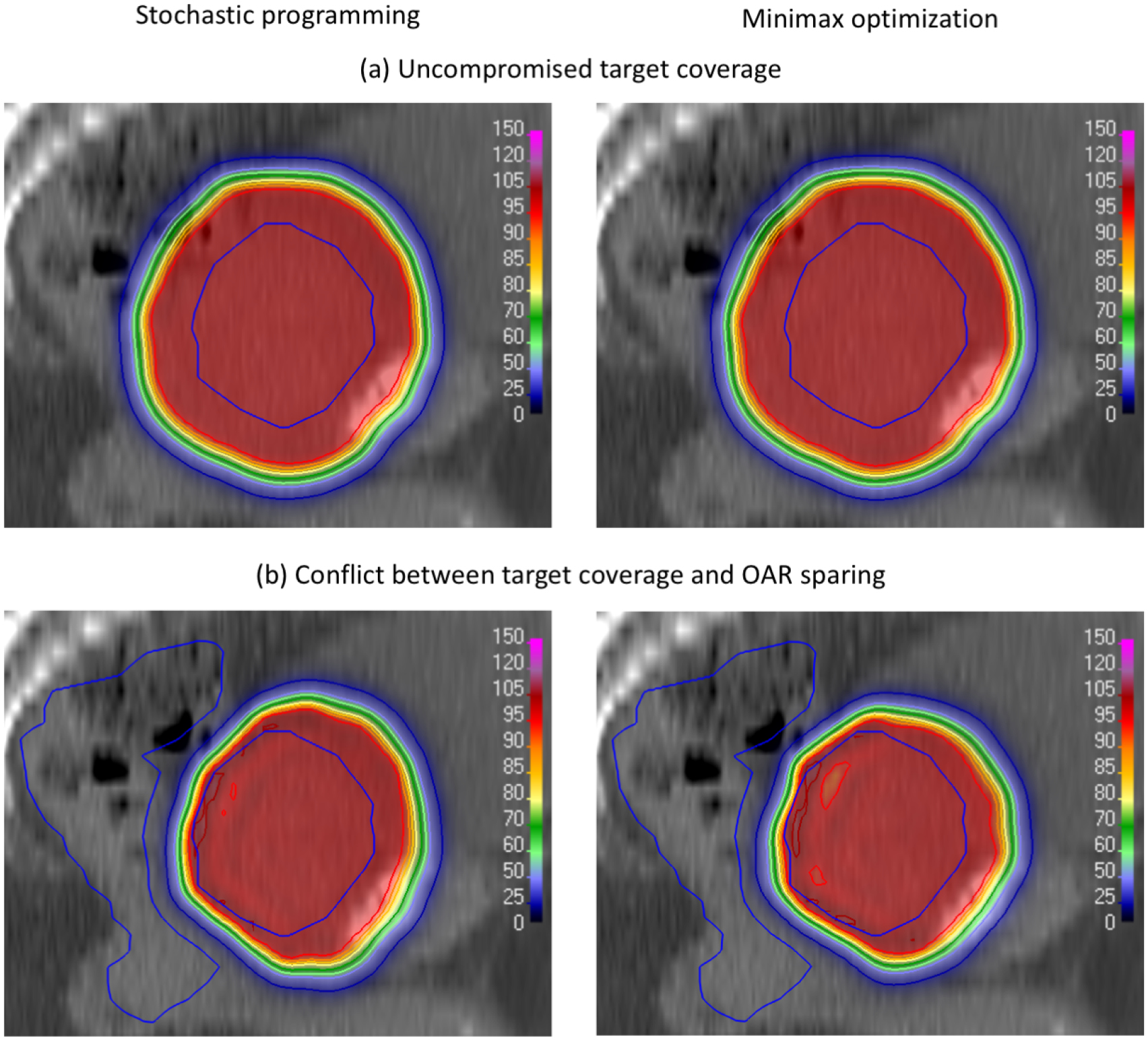 Robust radiotherapy planning - IOPscience
