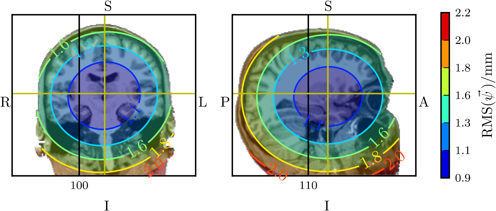 Quality assessment of MEG-to-MRI coregistrations - IOPscience