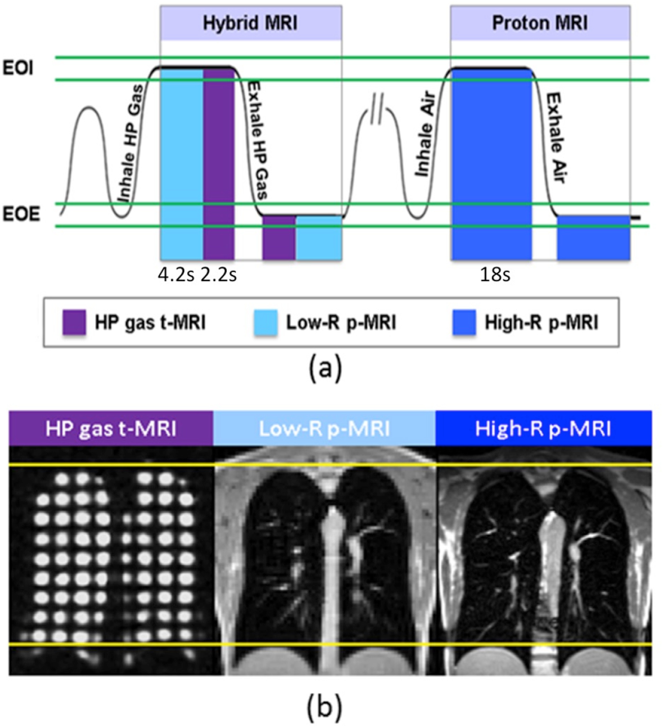 A hybrid proton and hyperpolarized gas tagging MRI technique for lung ...