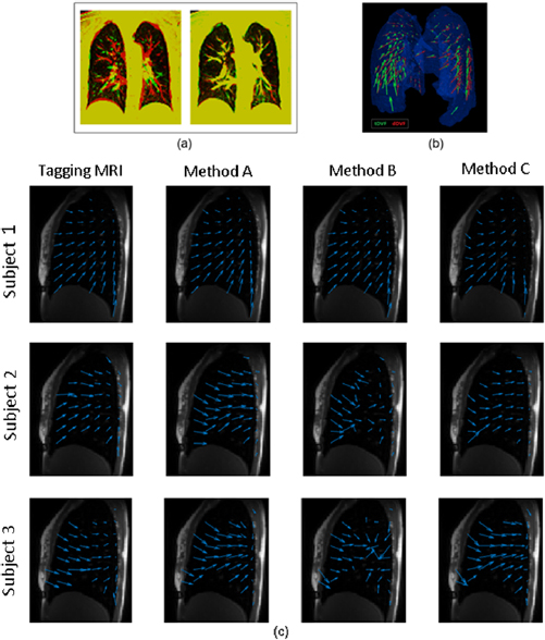 A hybrid proton and hyperpolarized gas tagging MRI technique for lung ...