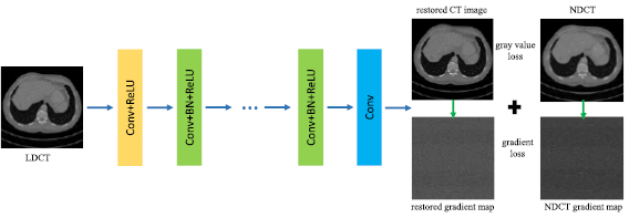 Gradient regularized convolutional neural networks for low-dose CT image enhancement - IOPscience