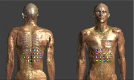The dielectric properties of skin and their influence on the delivery ...