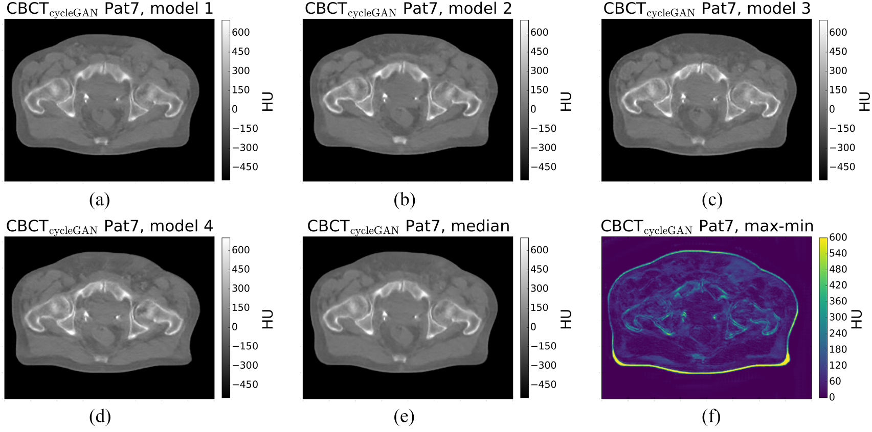 CBCT correction using a cycle-consistent generative adversarial network ...