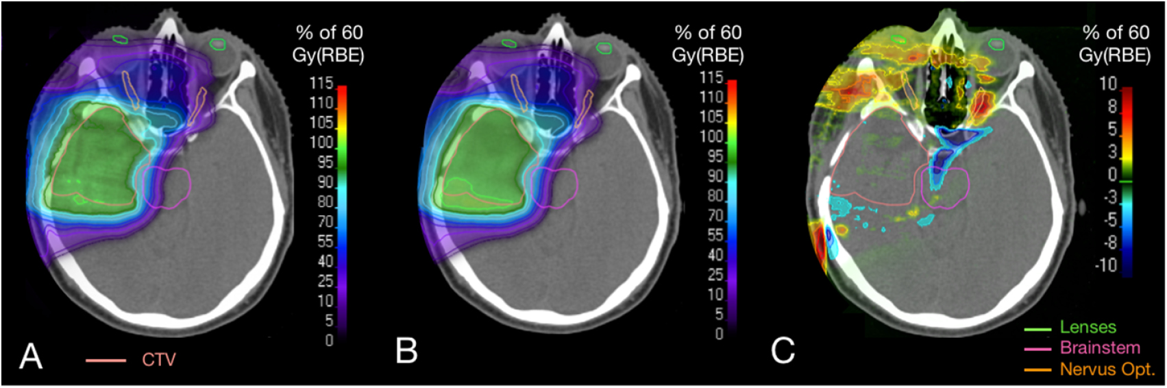 A Monte Carlo based radiation response modelling framework to assess ...