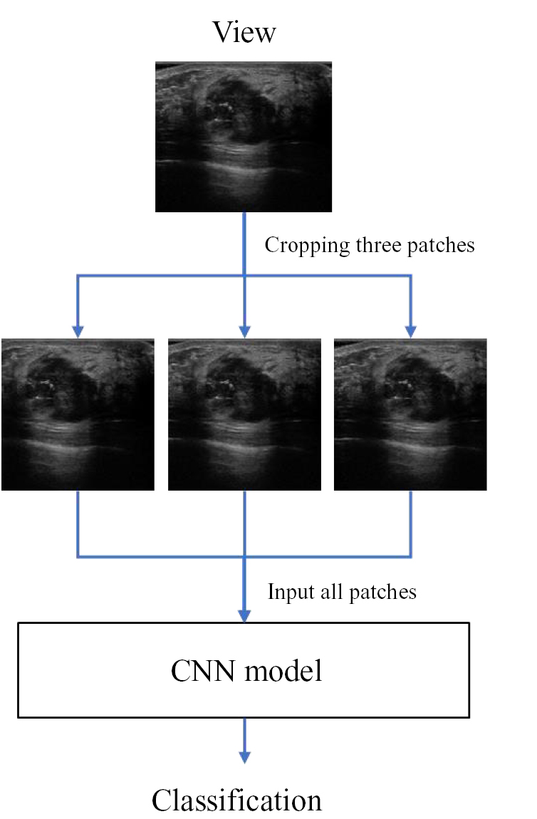Computer-aided diagnosis system for breast ultrasound images using deep ...