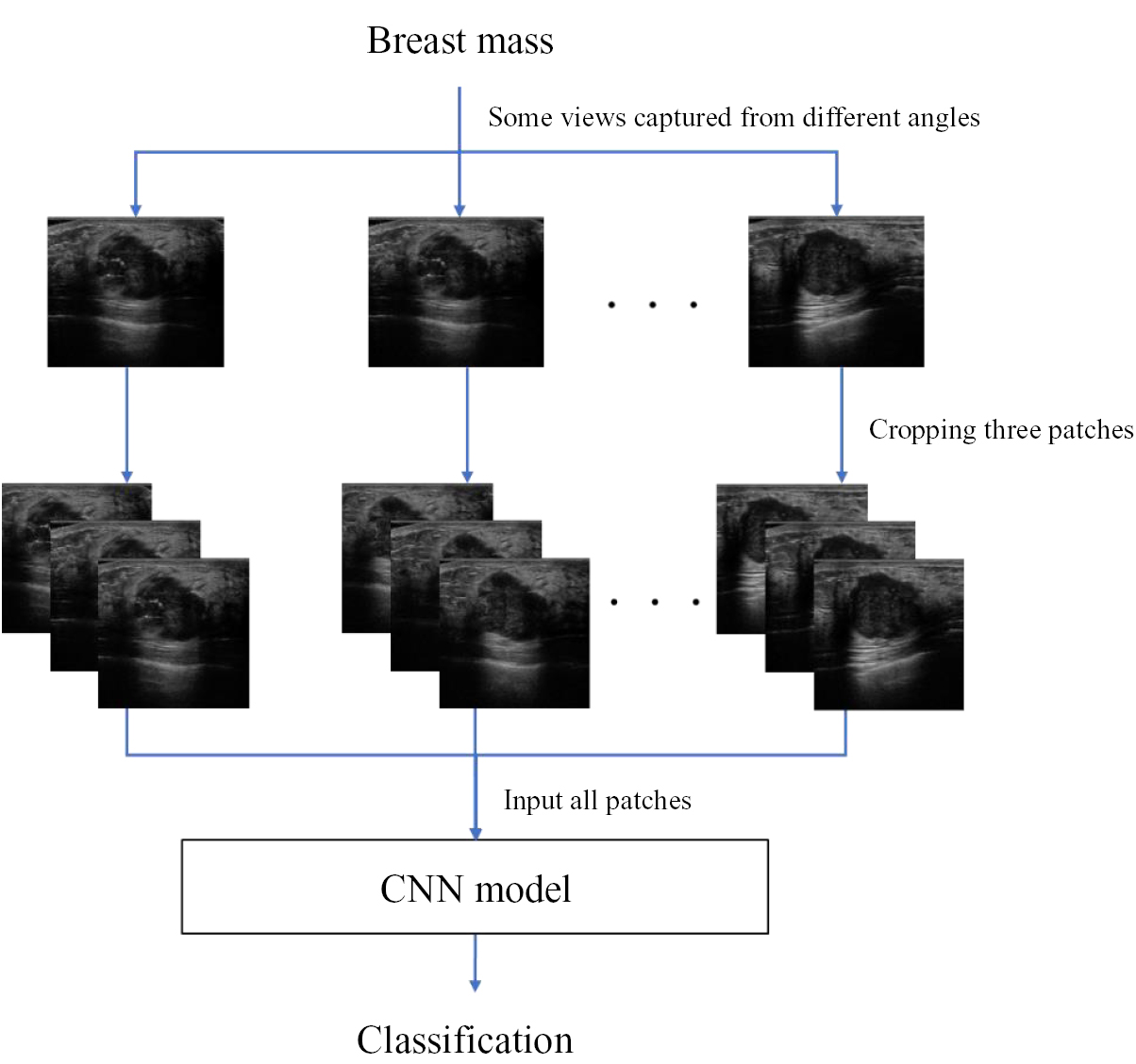 Computer-aided diagnosis system for breast ultrasound images using deep ...