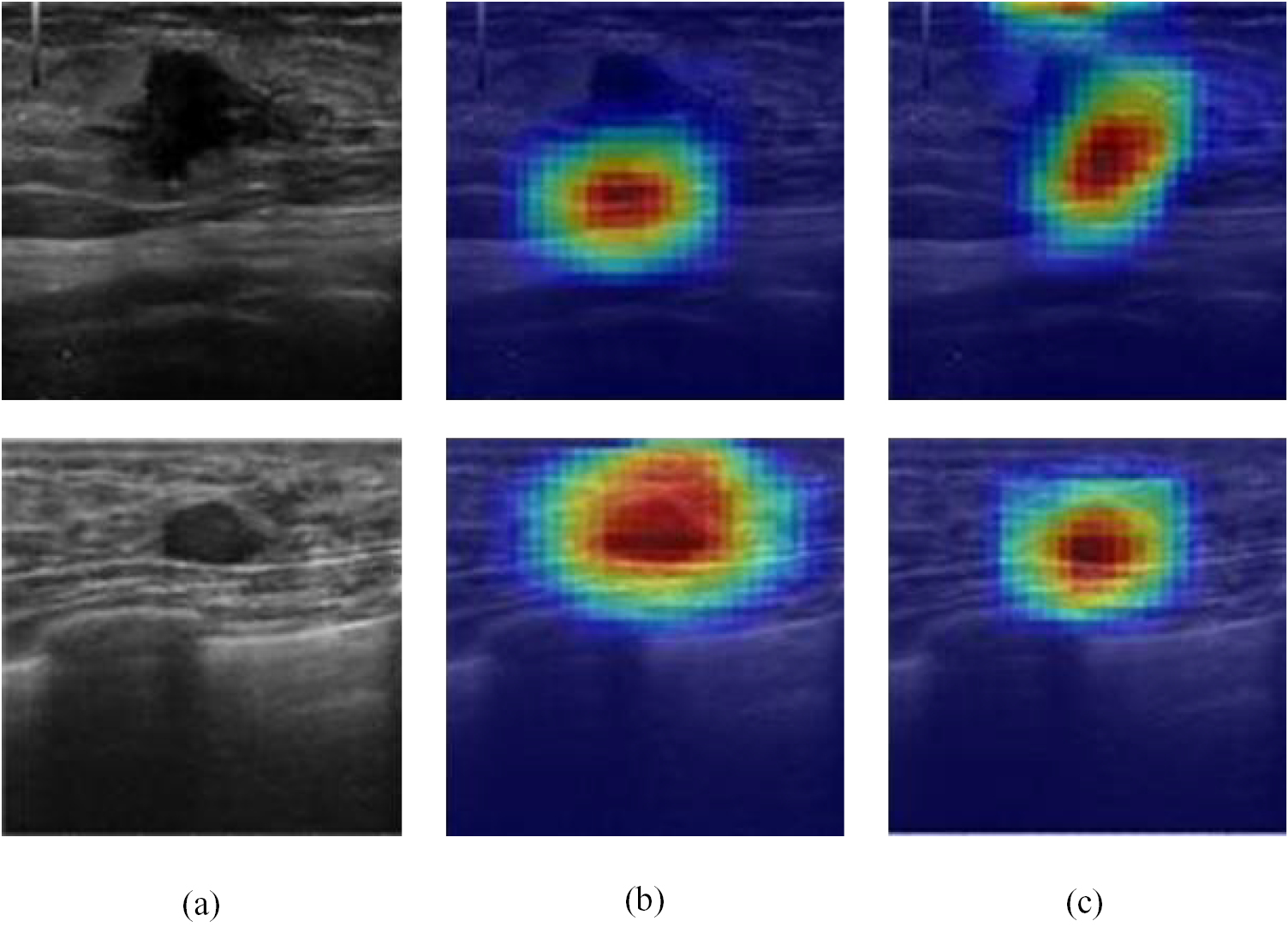 Computer-aided diagnosis system for breast ultrasound images using deep ...