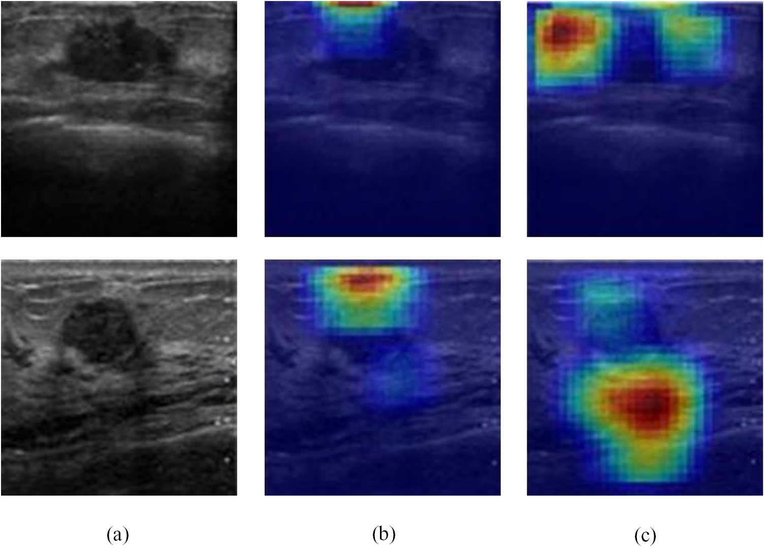 Computer-aided diagnosis system for breast ultrasound images using deep ...