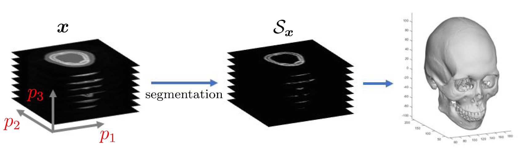 Automatic 3D cephalometric annotation system using shadowed 2D image-based machine learning ...