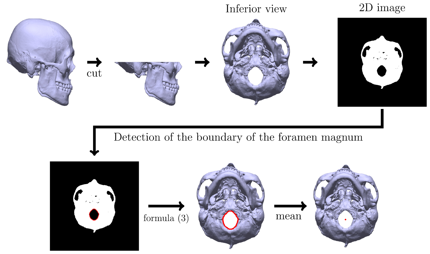 Automatic 3D cephalometric annotation system using shadowed 2D image-based machine learning ...