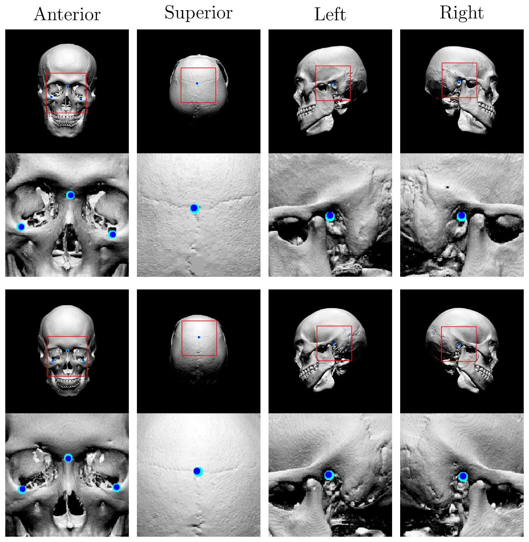 Automatic 3D cephalometric annotation system using shadowed 2D image-based machine learning ...