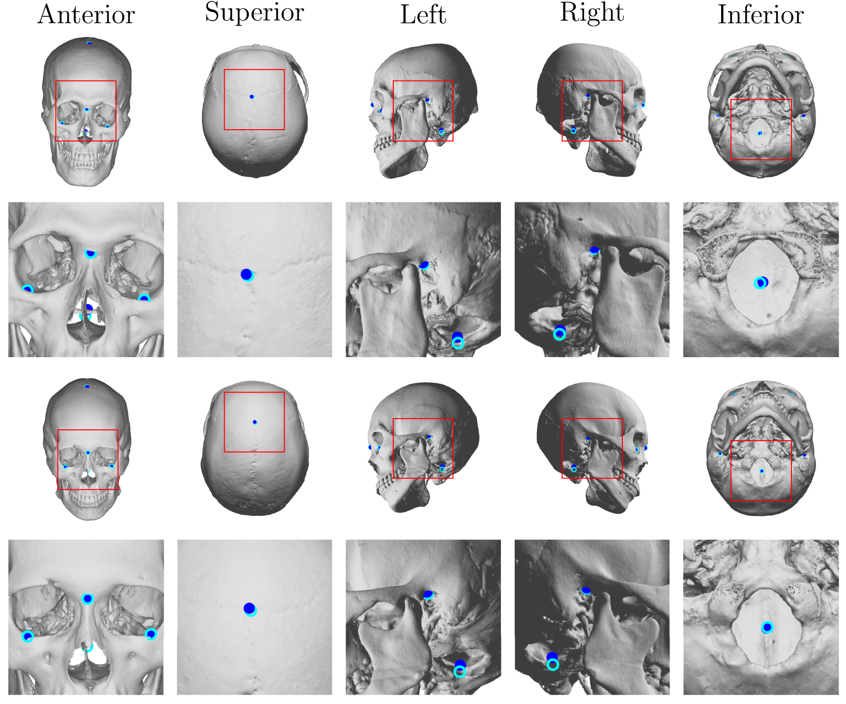Automatic 3D cephalometric annotation system using shadowed 2D image-based machine learning ...
