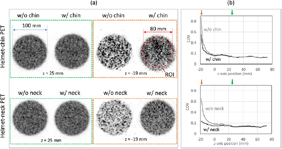 First prototyping of a dedicated PET system with the hemisphere ...