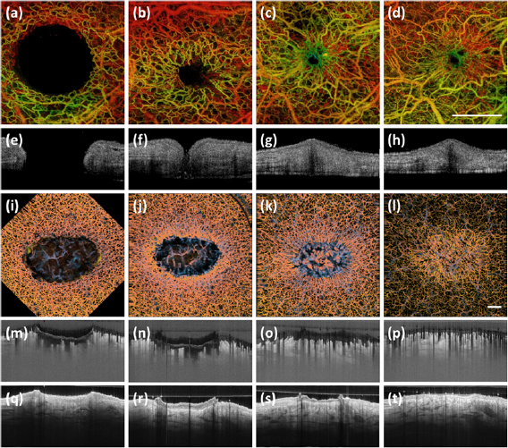 Microvascular imaging of the skin - IOPscience