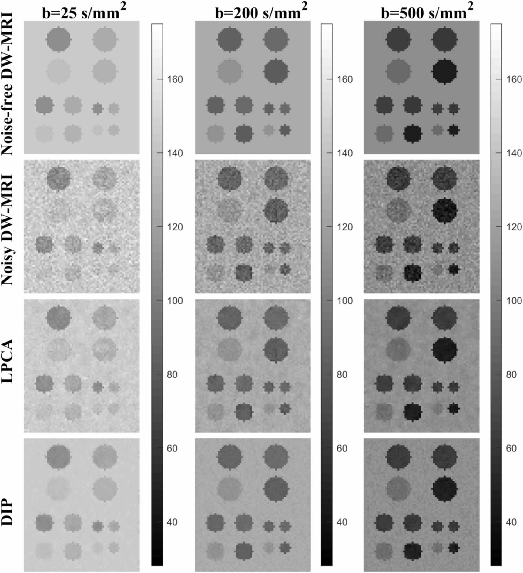 Denoising of multi b-value diffusion-weighted MR images using deep ...