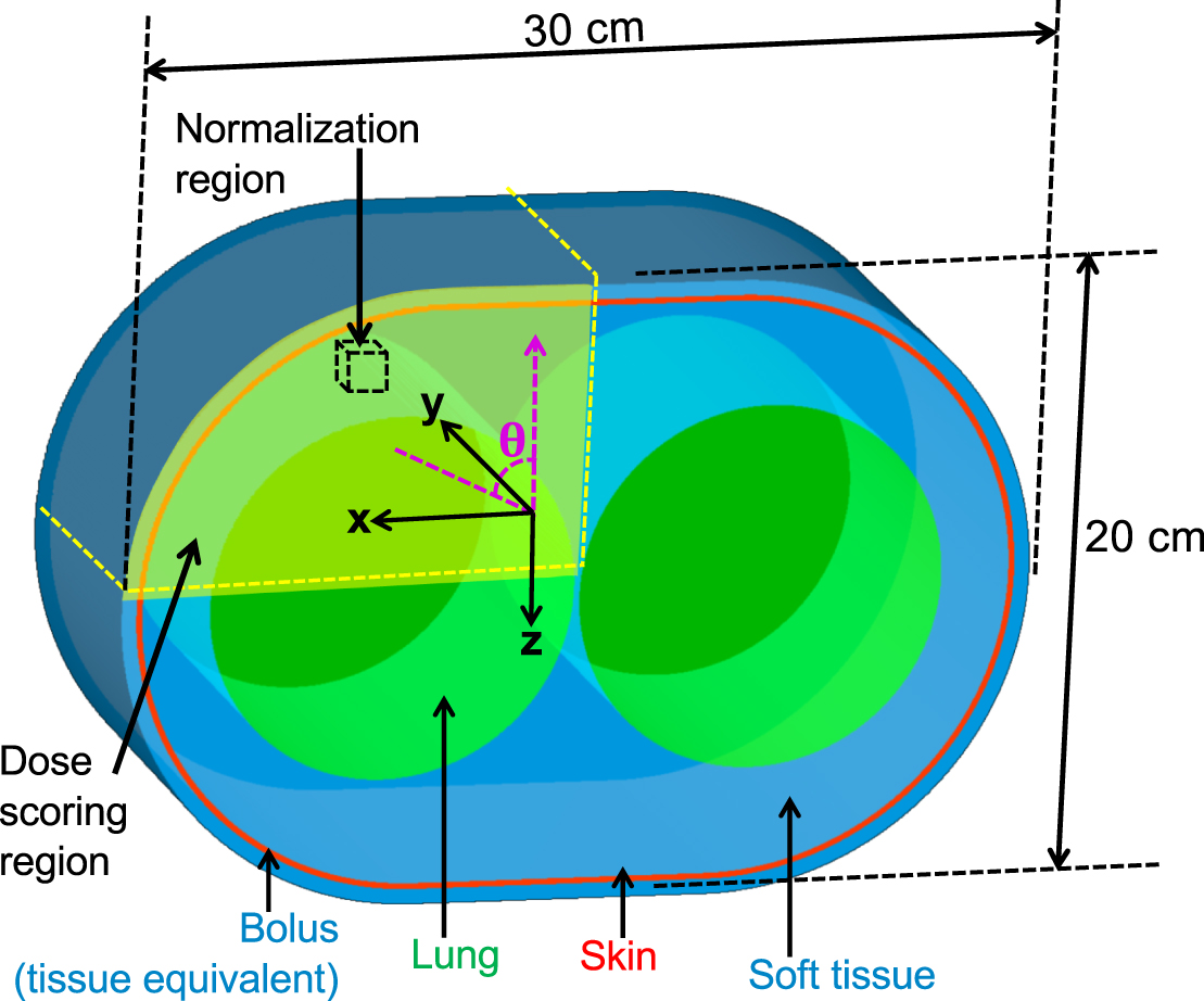 Skin dose in chest wall radiotherapy with bolus: a Monte Carlo study ...