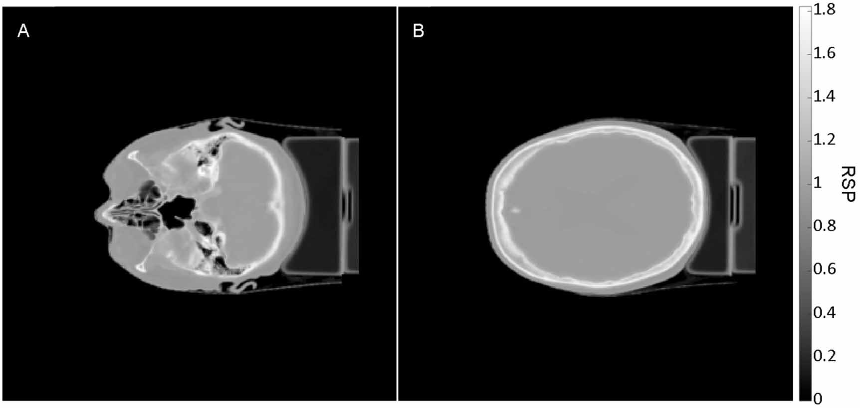 Patient-specific CT calibration based on ion radiography for different ...