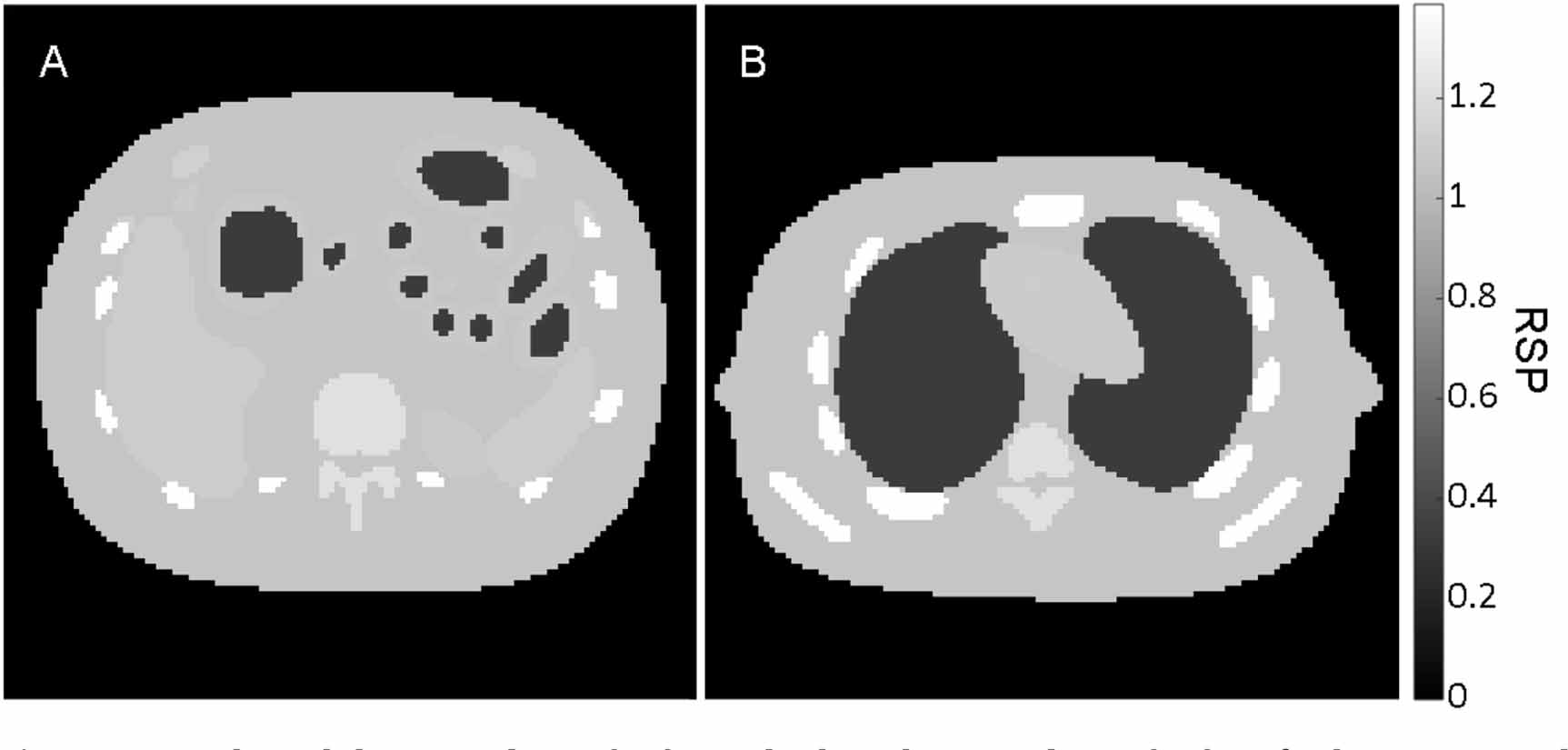 Patient-specific CT calibration based on ion radiography for different ...