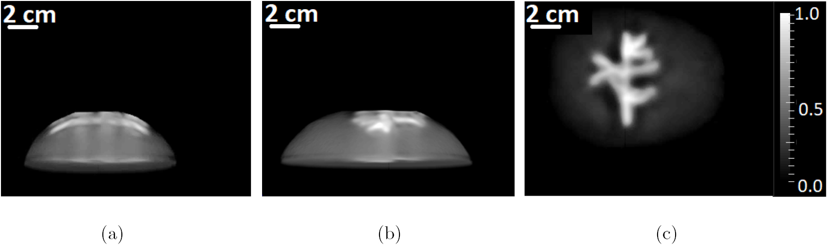 Iterative image reconstruction in transcranial photoacoustic tomography ...