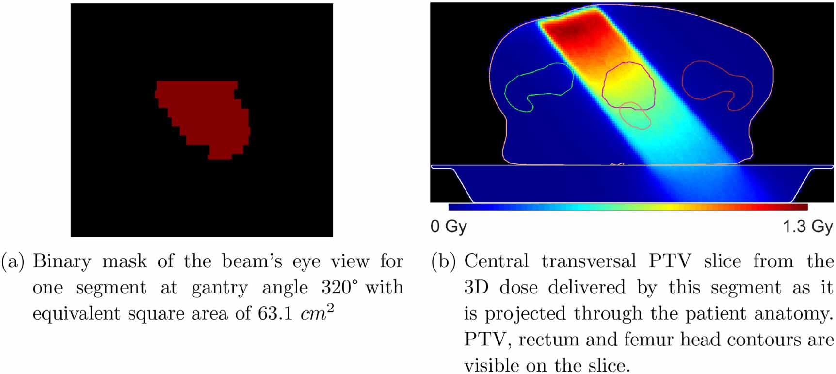 DeepDose: Towards a fast dose calculation engine for radiation therapy ...