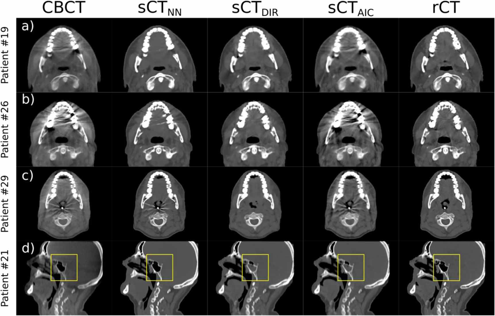 Comparison of CBCT based synthetic CT methods suitable for proton dose ...