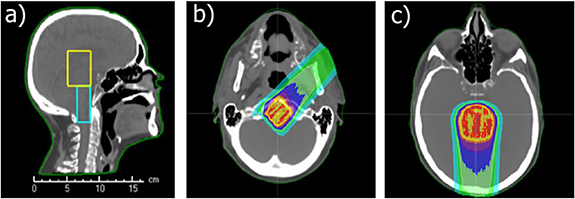 Comparison of CBCT based synthetic CT methods suitable for proton dose ...
