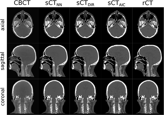 Comparison of CBCT based synthetic CT methods suitable for proton dose ...