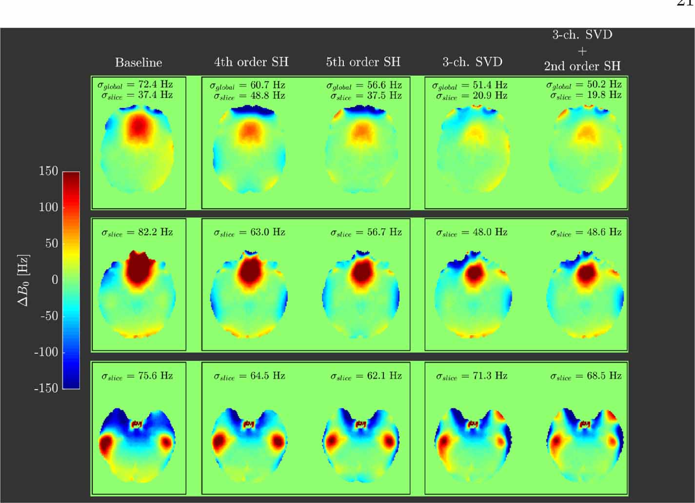 A fieldmap-driven few-channel shim coil design for MRI of the human ...