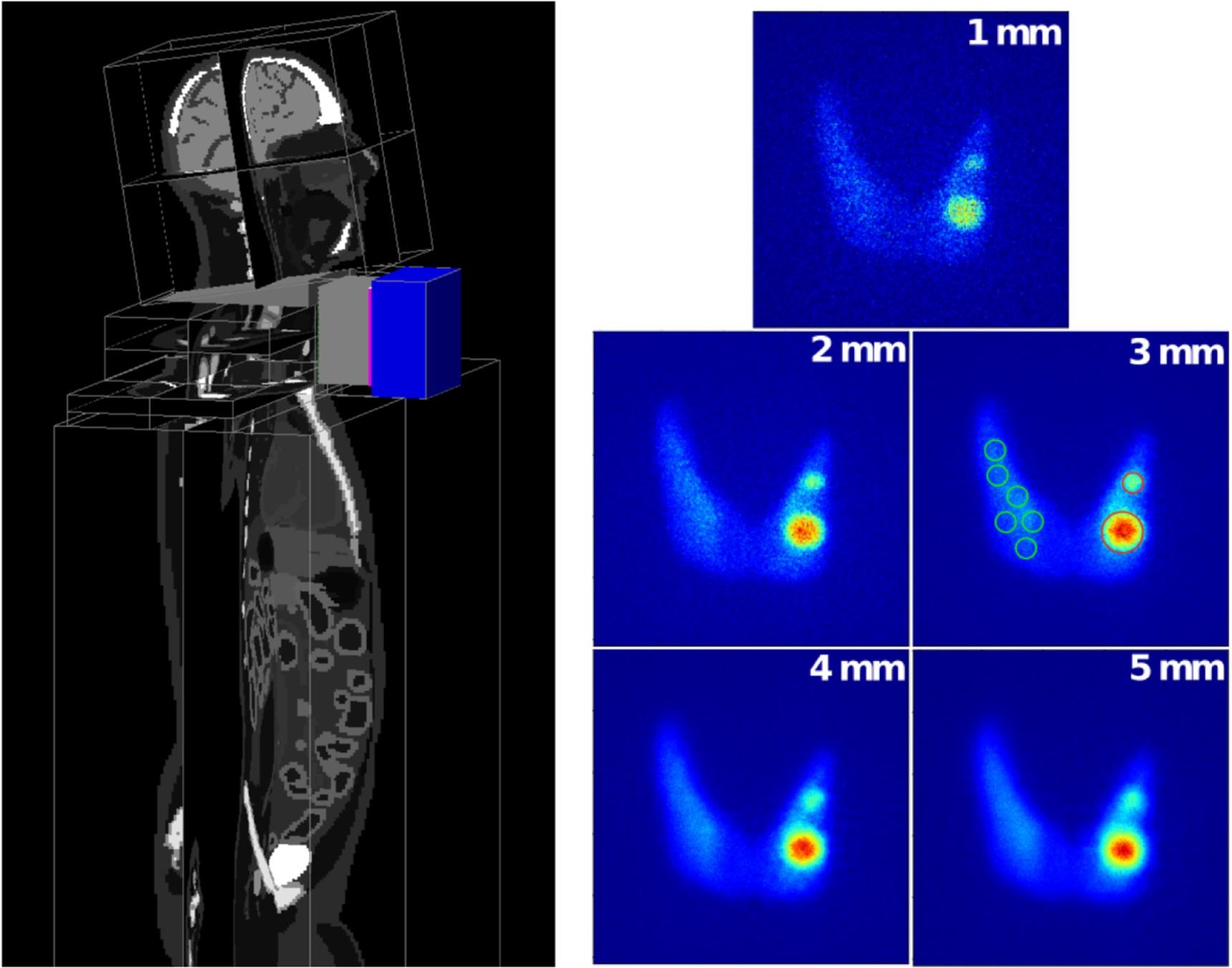 Advanced Monte Carlo simulations of emission tomography imaging systems ...