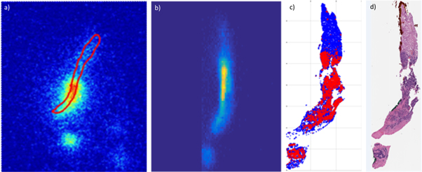 Advanced Monte Carlo simulations of emission tomography imaging systems with GATE - IOPscience