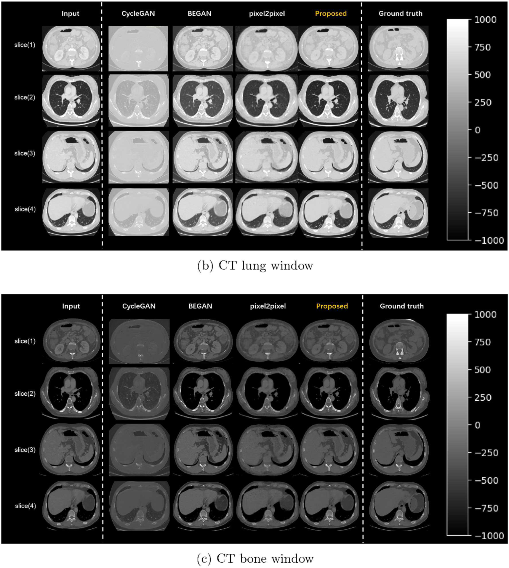 Contrast-enhanced to noncontrast CT transformation via an adjacency ...