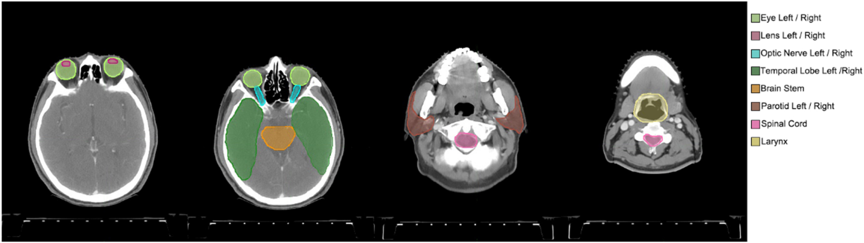 The impact of training sample size on deep learning-based organ auto ...