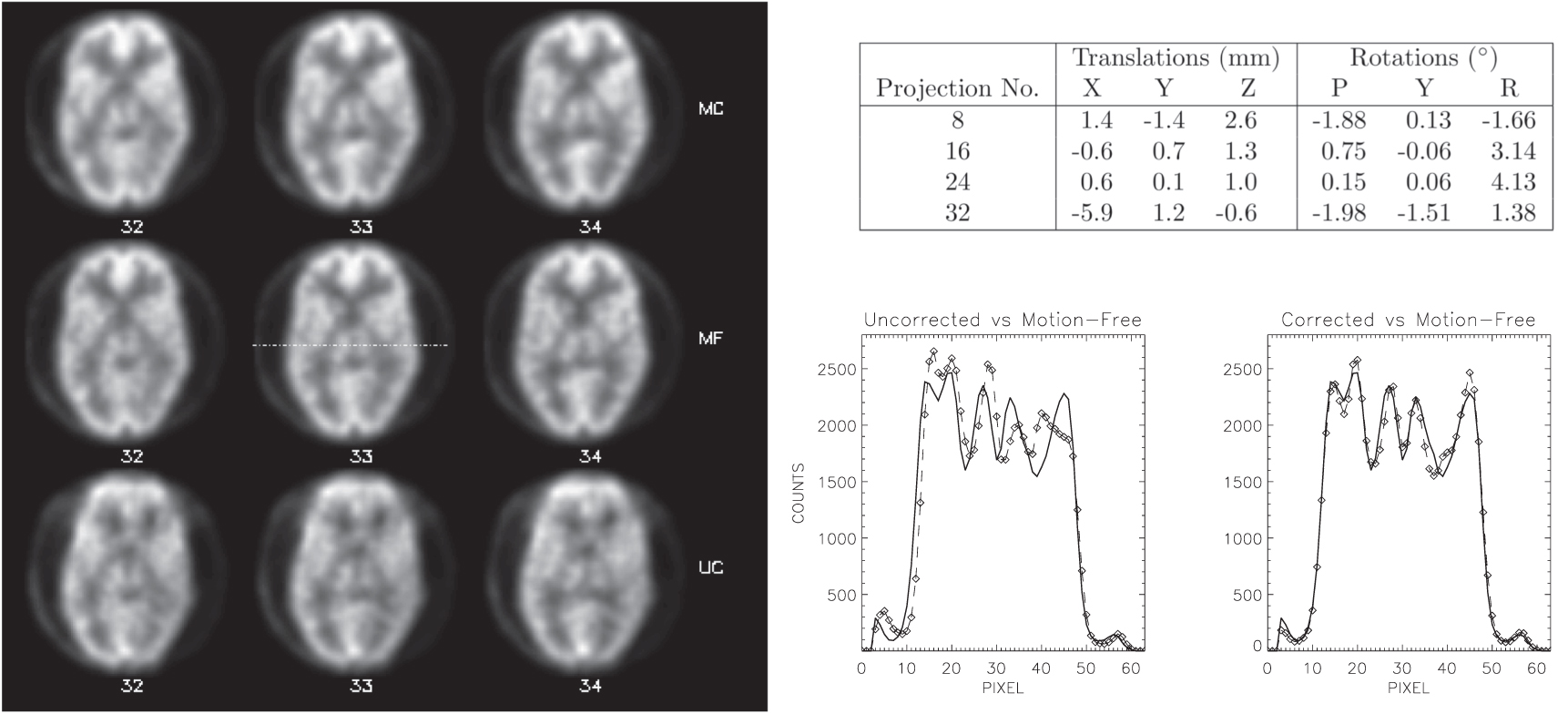 Motion estimation and correction in SPECT, PET and CT - IOPscience