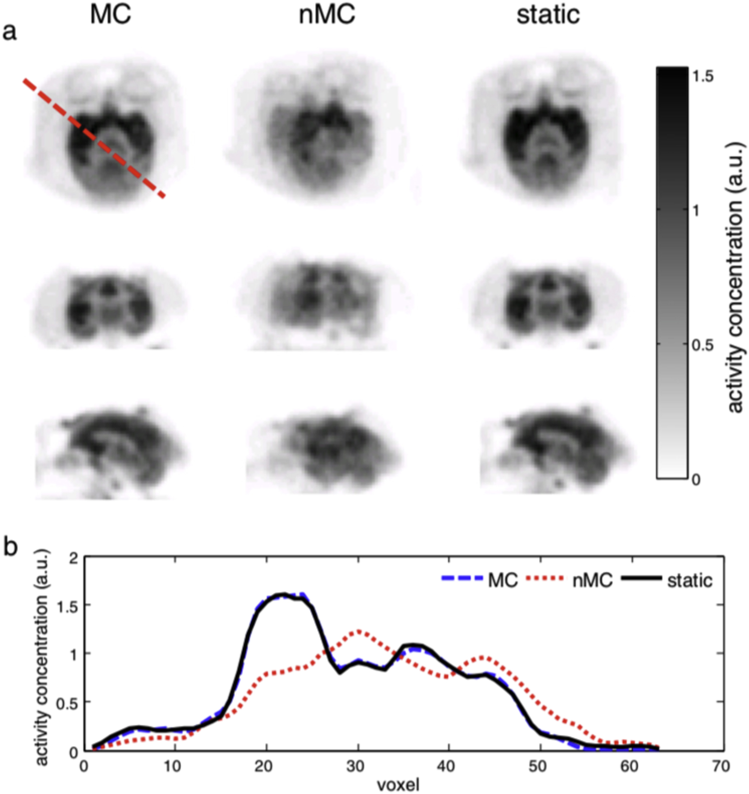 Motion estimation and correction in SPECT, PET and CT - IOPscience