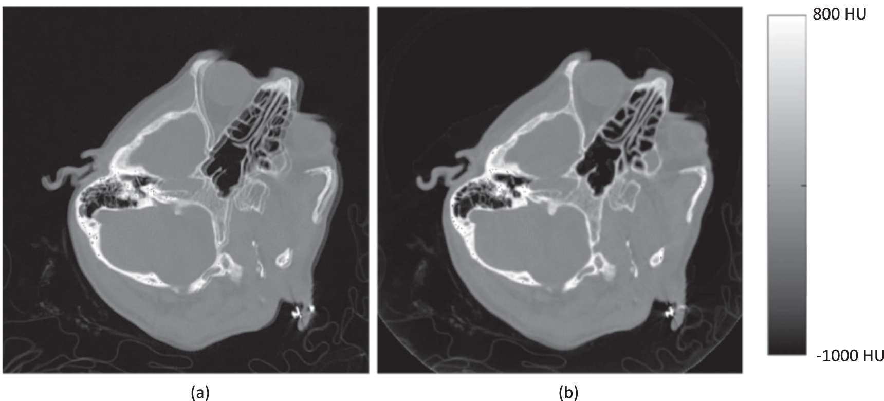 Motion estimation and correction in SPECT, PET and CT - IOPscience