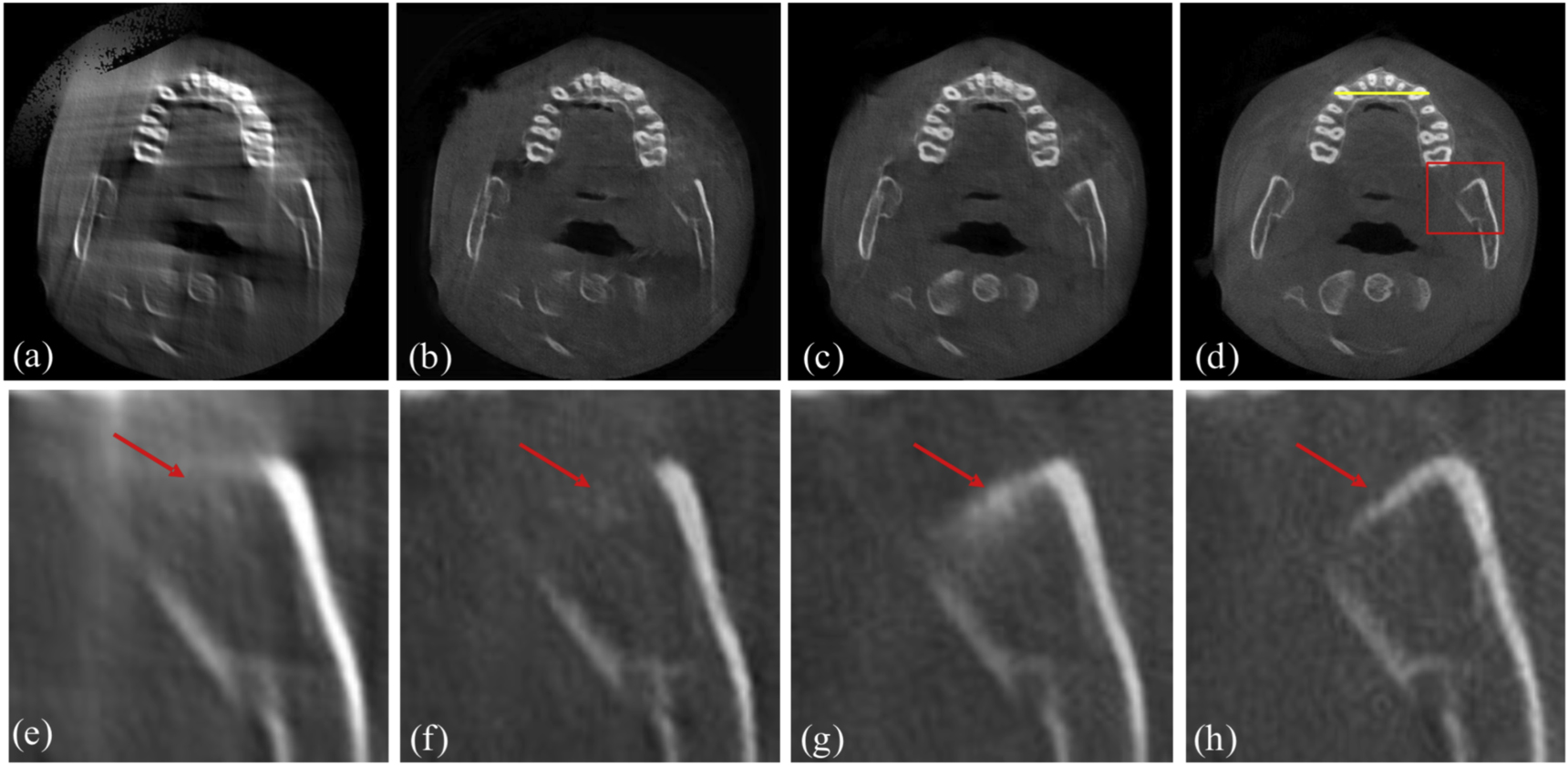 Motion estimation and correction in SPECT, PET and CT - IOPscience