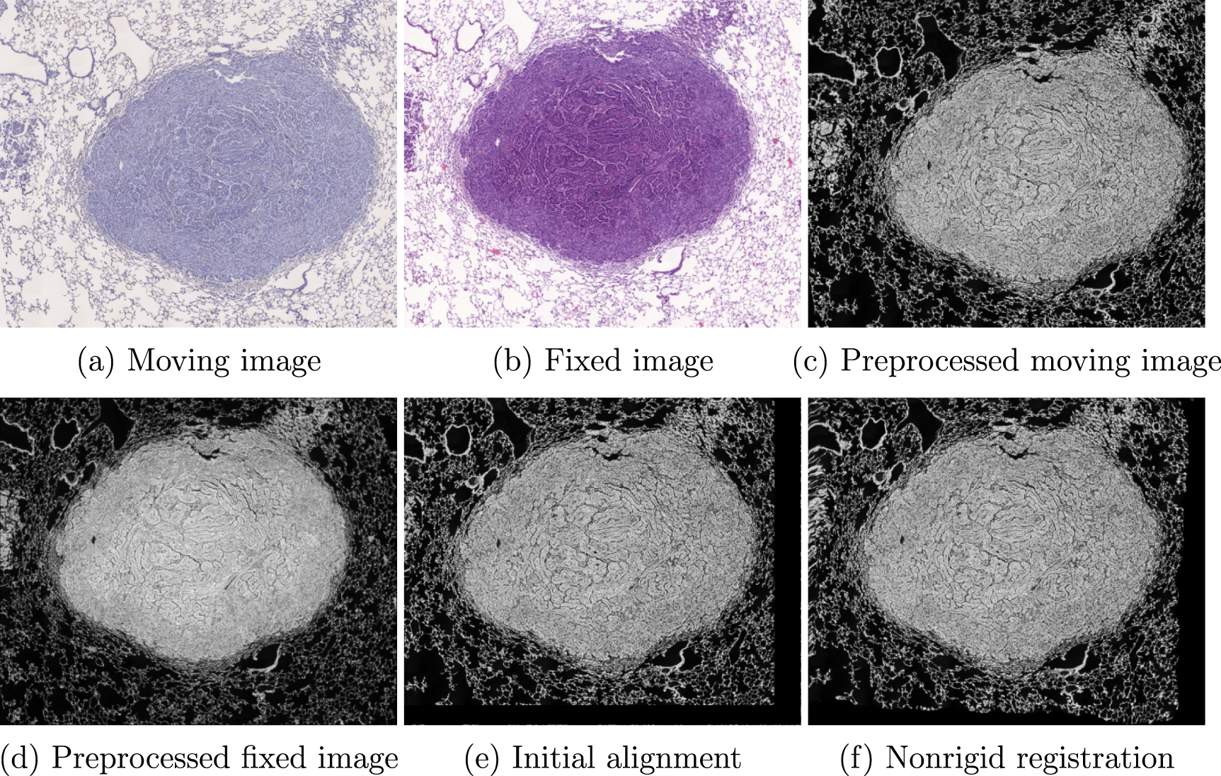 Multistep, automatic and nonrigid image registration method for histology samples acquired using ...