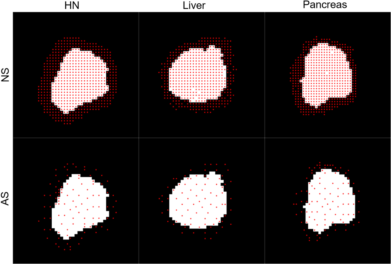 An adaptive spot placement method on Cartesian grid for pencil beam ...