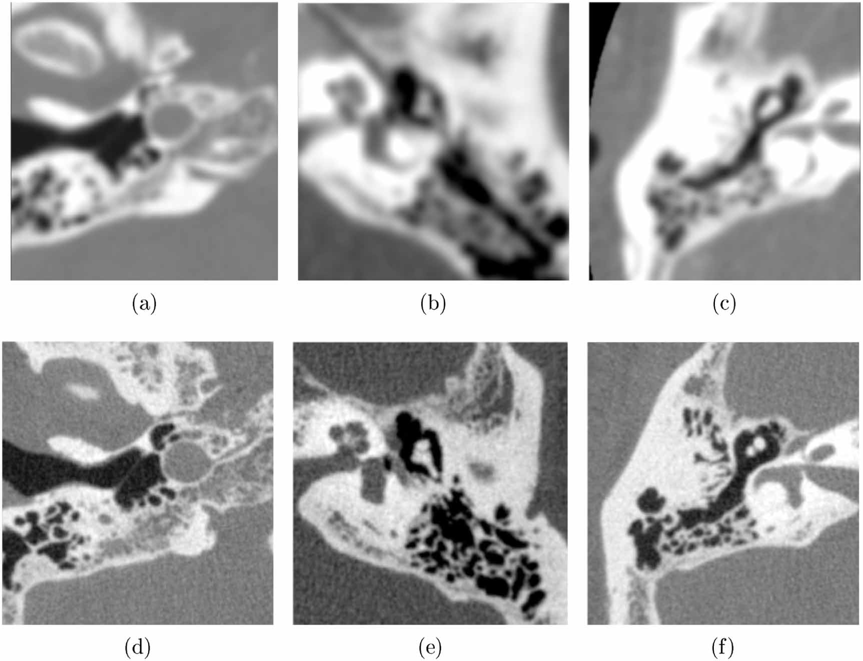 Photon-counting x-ray detectors for CT - IOPscience