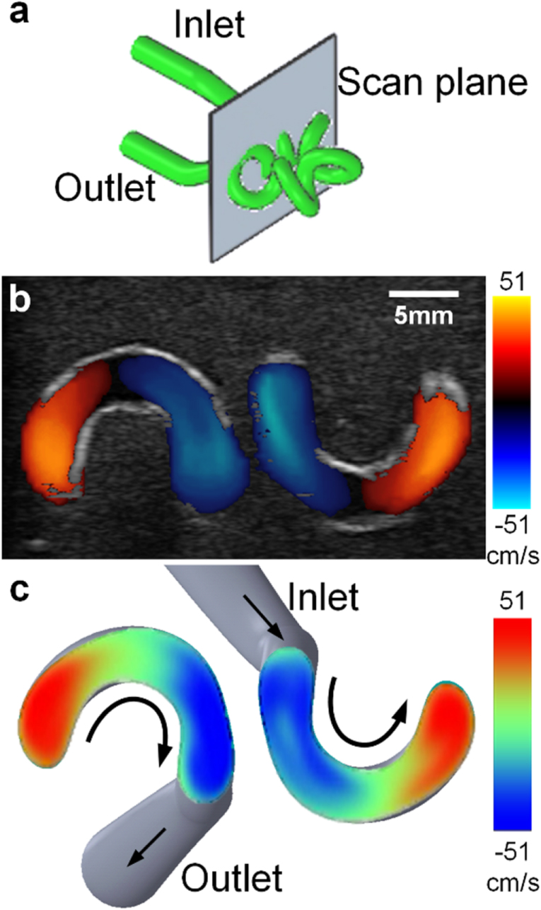 Helical toroid phantom for 3D flow imaging investigations - IOPscience