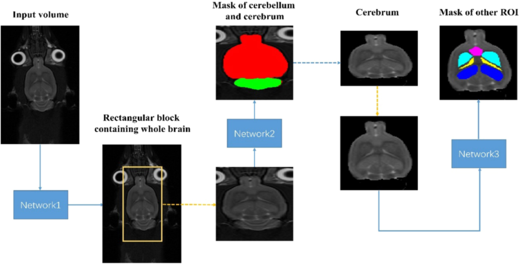 Automatic rat brain image segmentation using triple cascaded ...