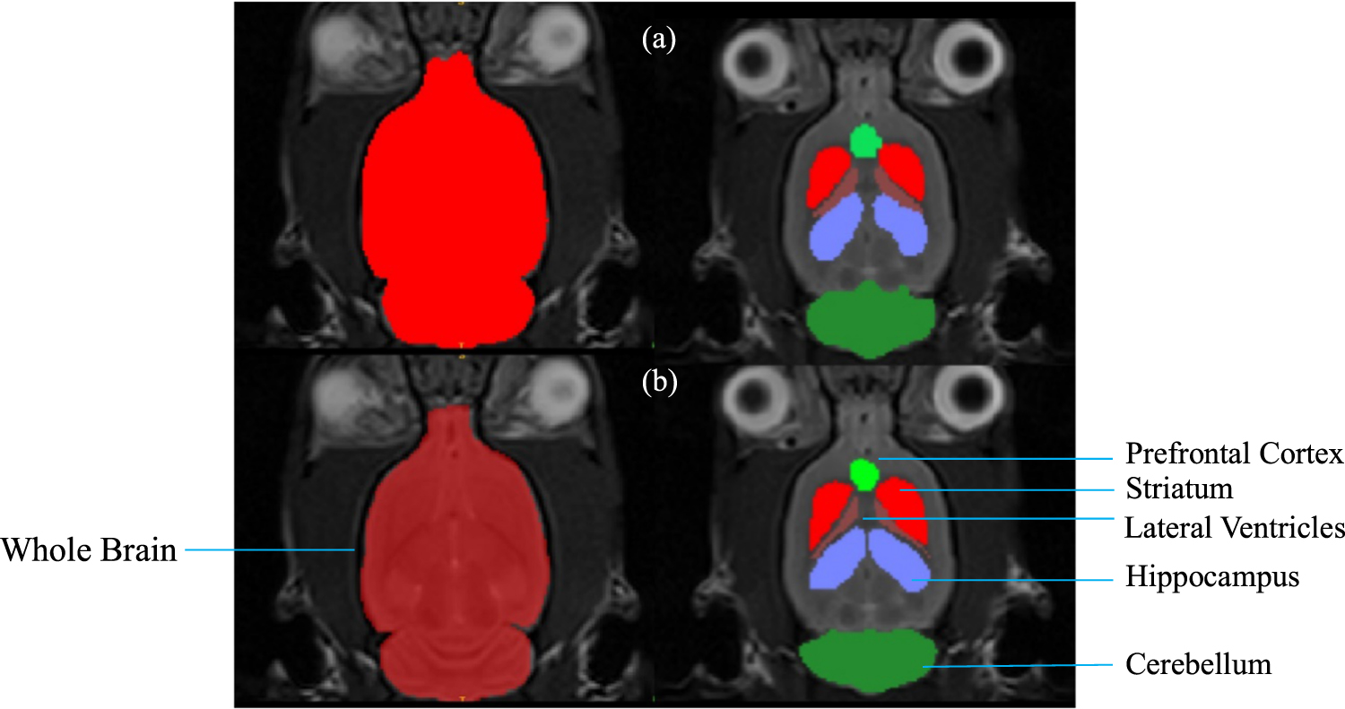 Automatic rat brain image segmentation using triple cascaded ...