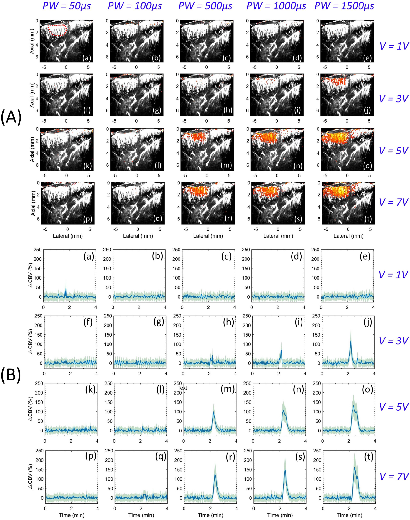 Imaging the response to deep brain stimulation in rodent using ...