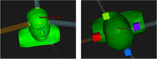 Considerations for shoot-through FLASH proton therapy - IOPscience