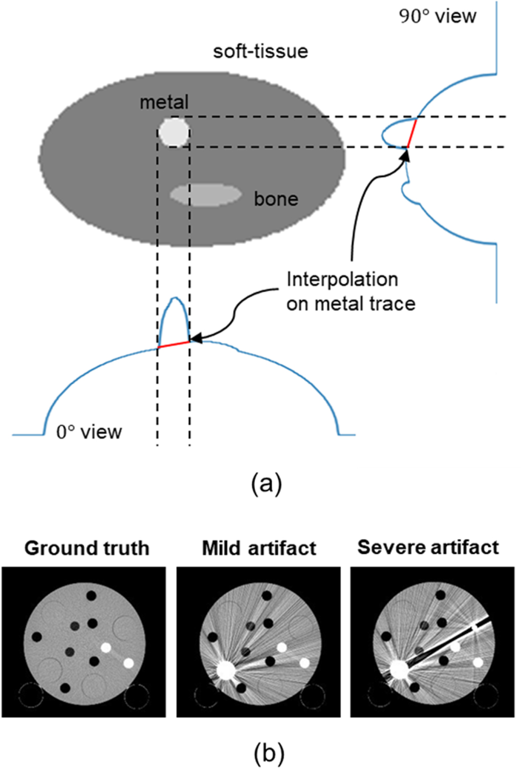 CLIMAR: classified linear interpolation based metal artifact reduction ...