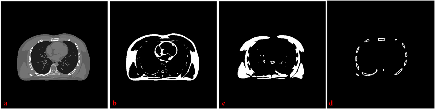 Iterative dynamic dual-energy CT algorithm in reducing statistical ...