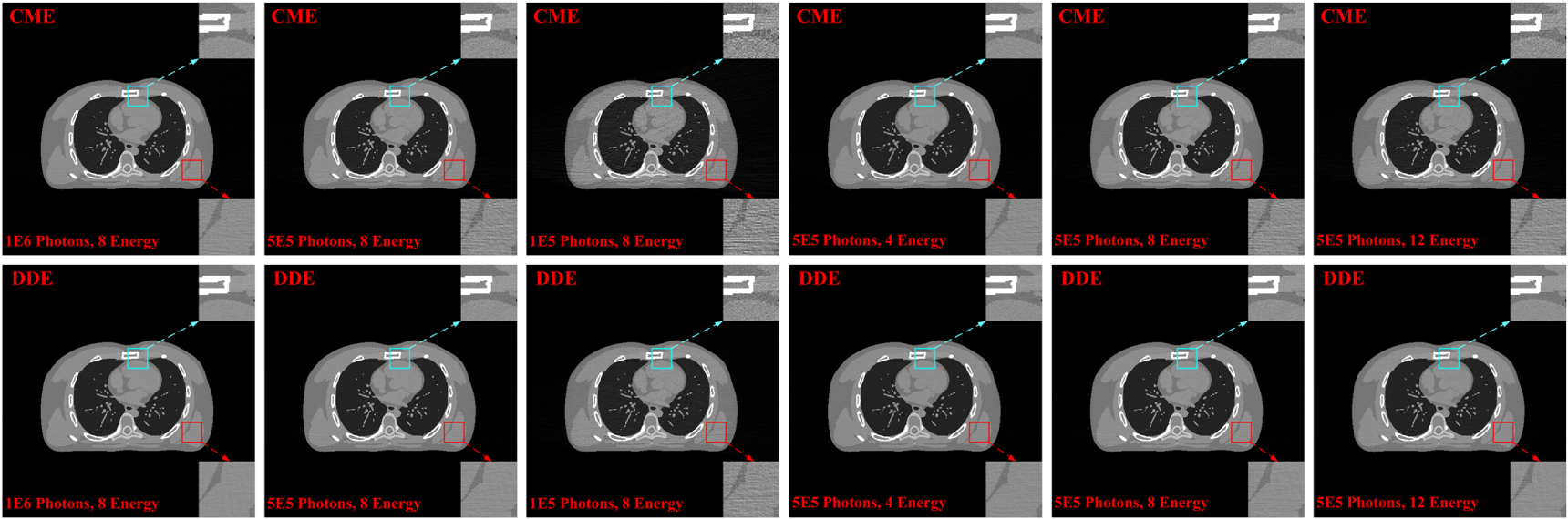 Iterative dynamic dual-energy CT algorithm in reducing statistical ...