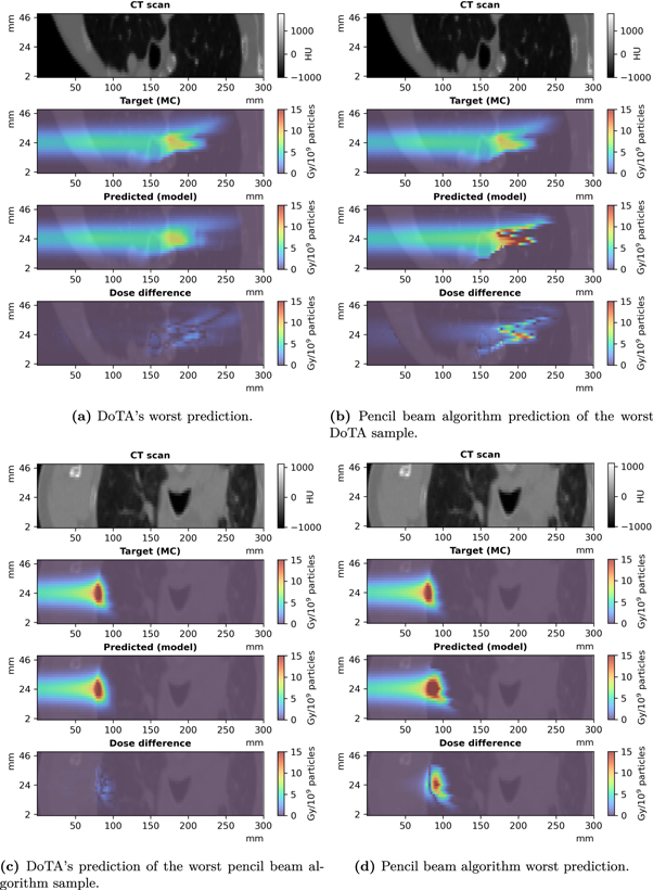 Millisecond speed deep learning based proton dose calculation with Monte Carlo accuracy - IOPscience